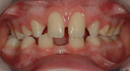 The Right Time for an Orthodontic Check Up