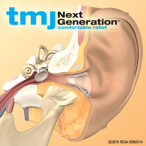 TMJ Houston | TMD Orthodontist | Advance Orthodontics TMJ Houston | TMD Orthodontist | Advance Orthodontics